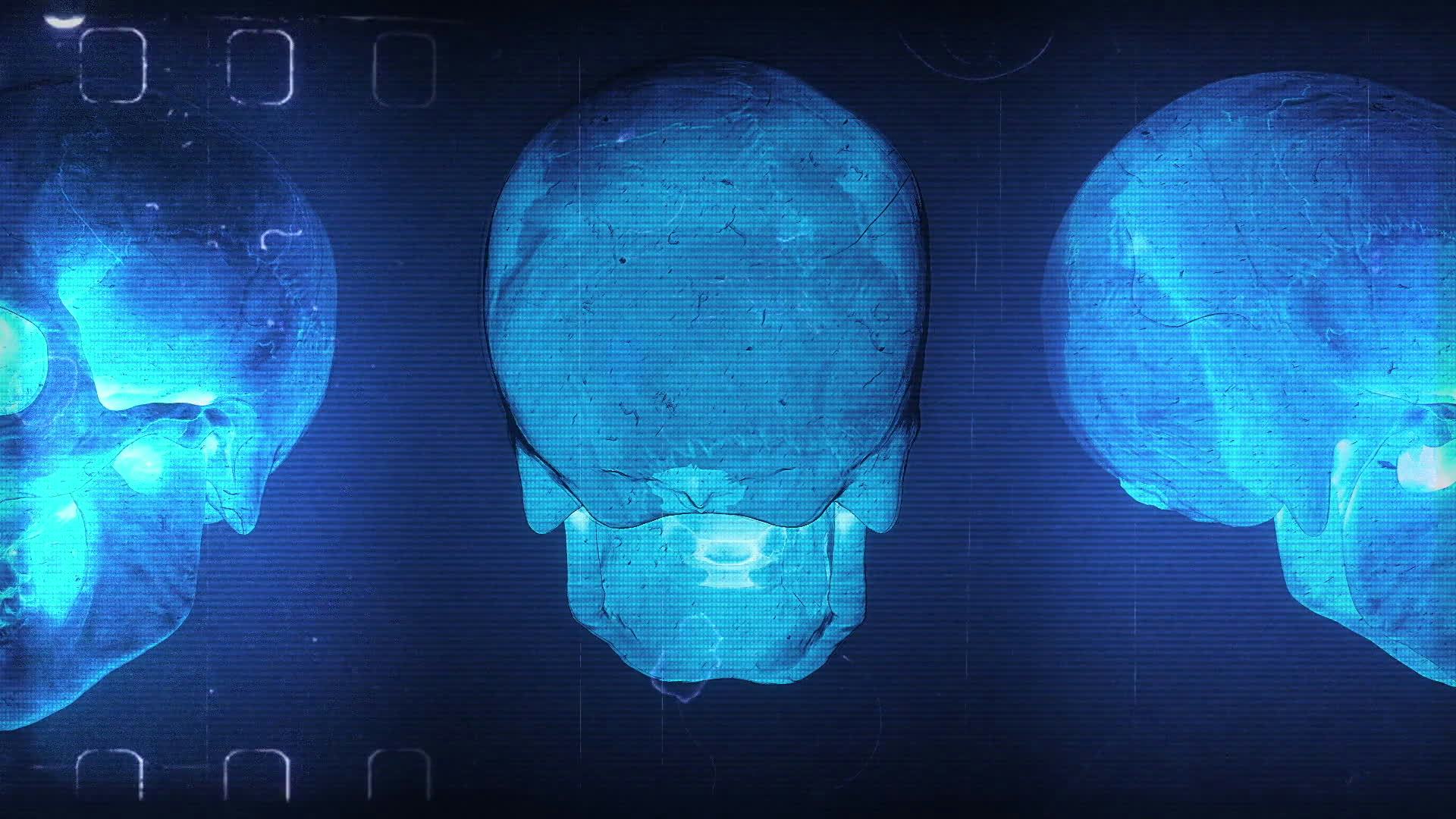 Medical Chart Skull • Free Motion Graphics Template • Uppbeat